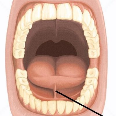 Cirurgia Oral Menor – Ana Riso Odontologia